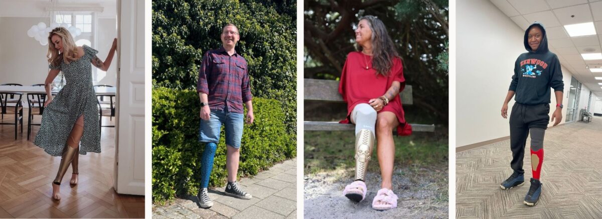 Anatomic Studios | Personalized prosthetic covers